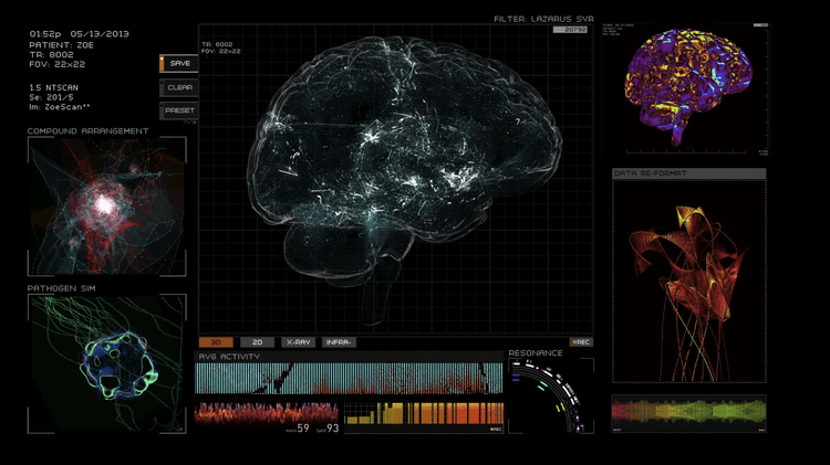 The Lazarus Effect — brandon parvini