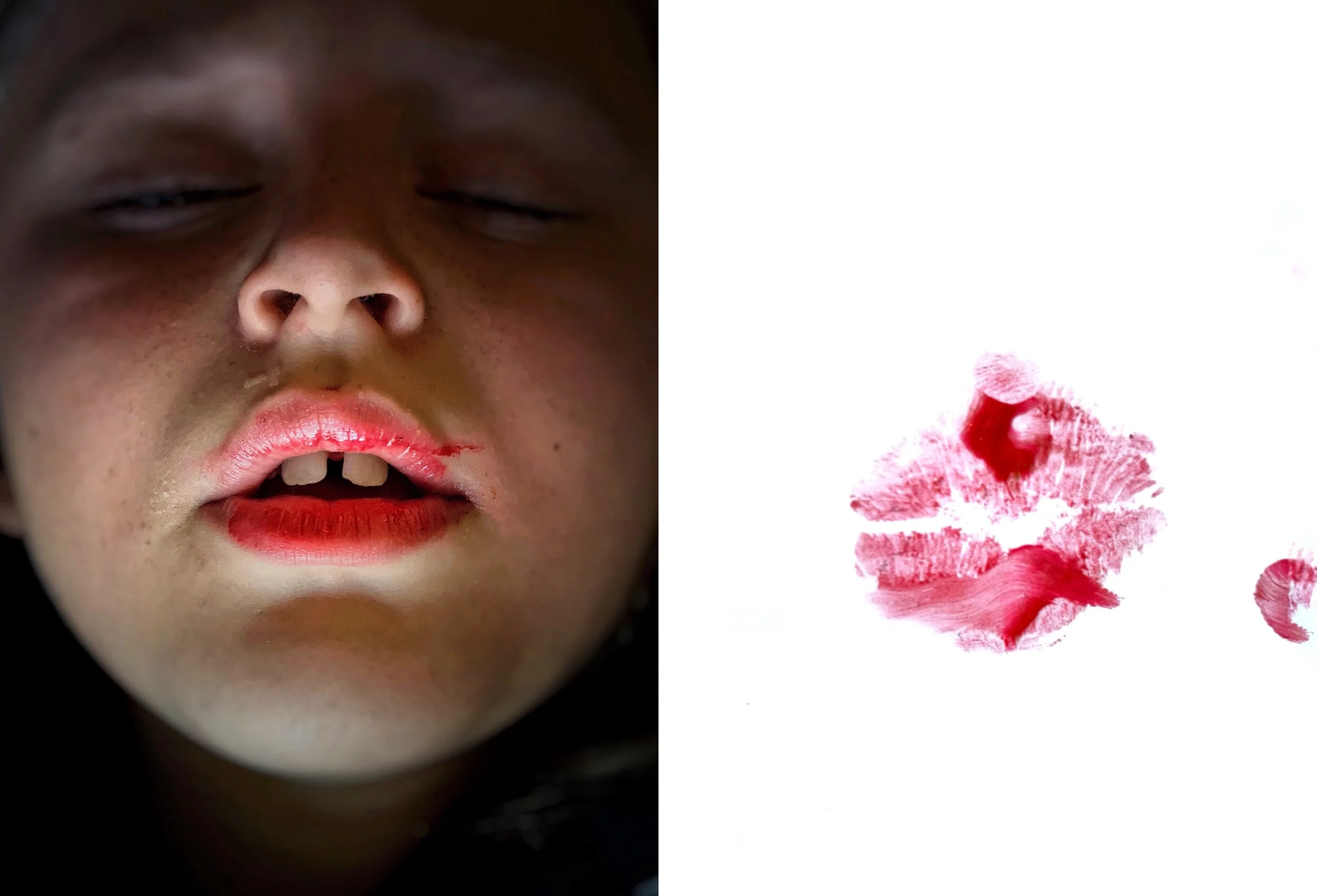 Bleeding Lips Tumblr