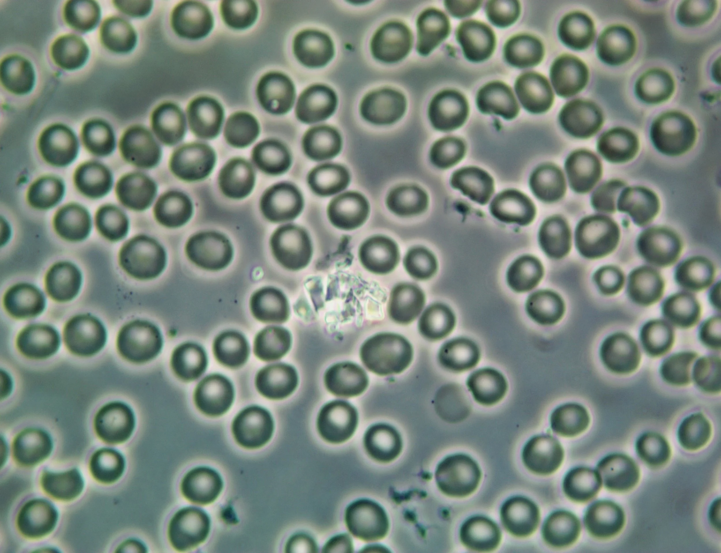 Live Blood Cell Microscopy — Melody Prinzen-Logan