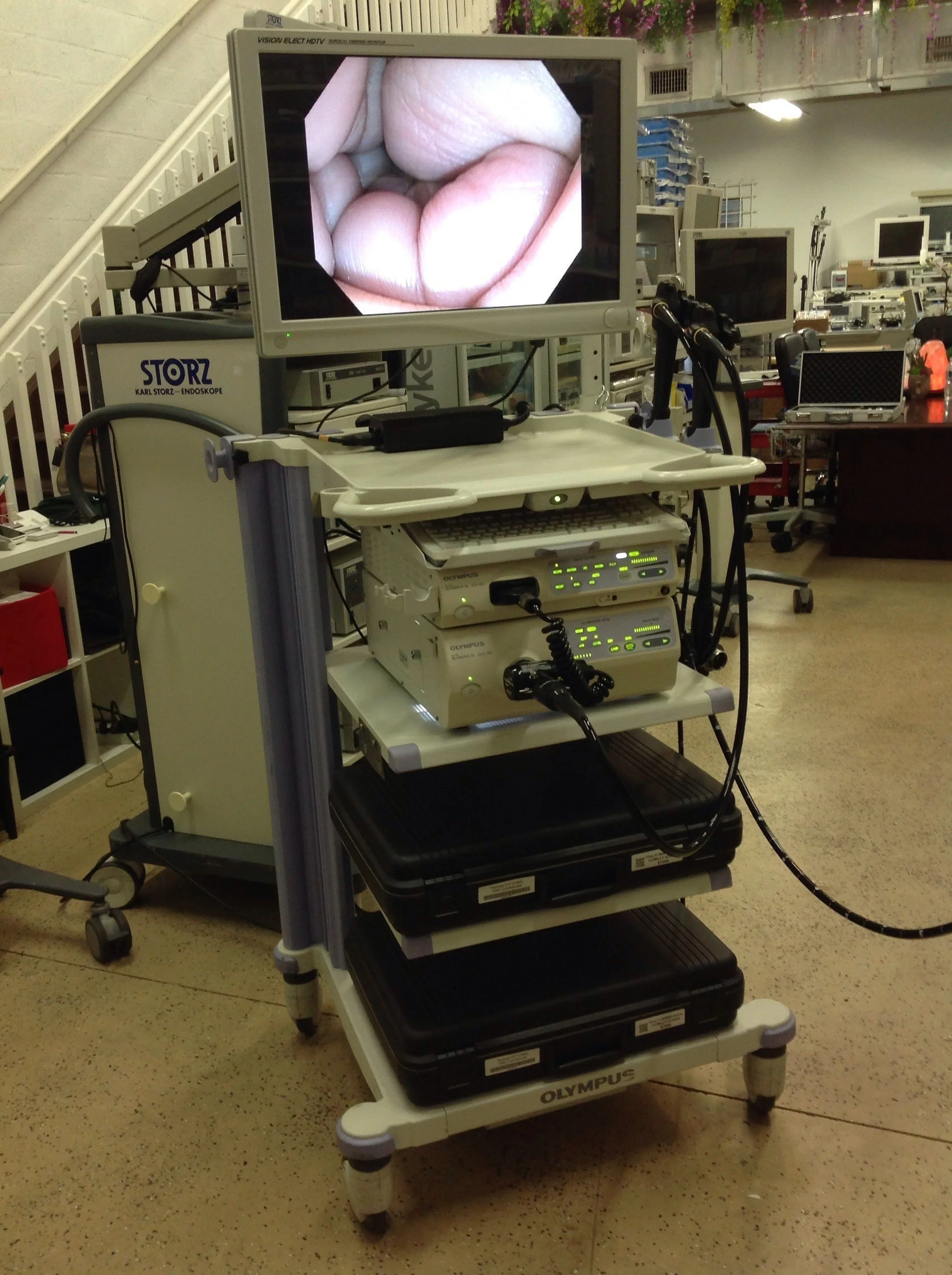 Endoscopy equipment and instruments rigid and flexible. Different ...