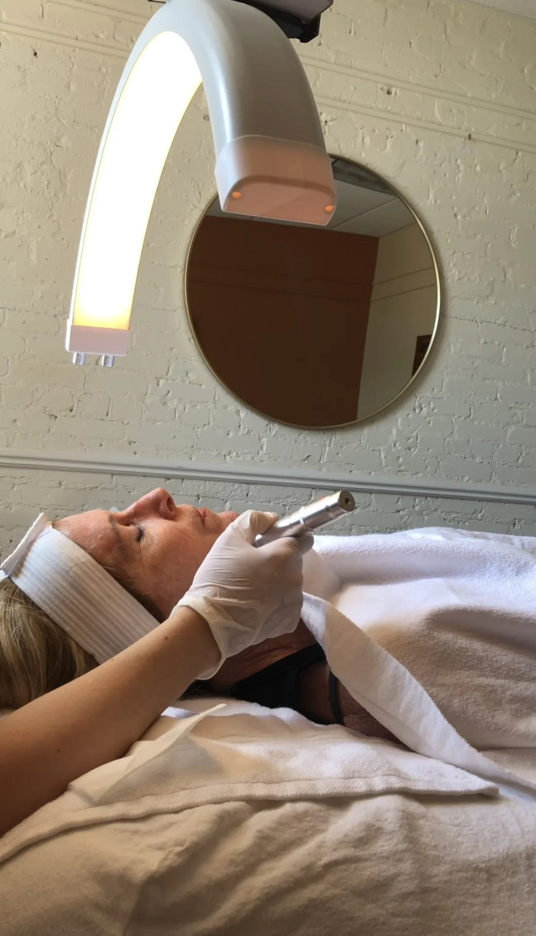 Roots Acupuncture - Acupuncture + Microneedling