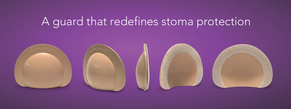 StomaDome: Stoma Guard for Any Ostomy