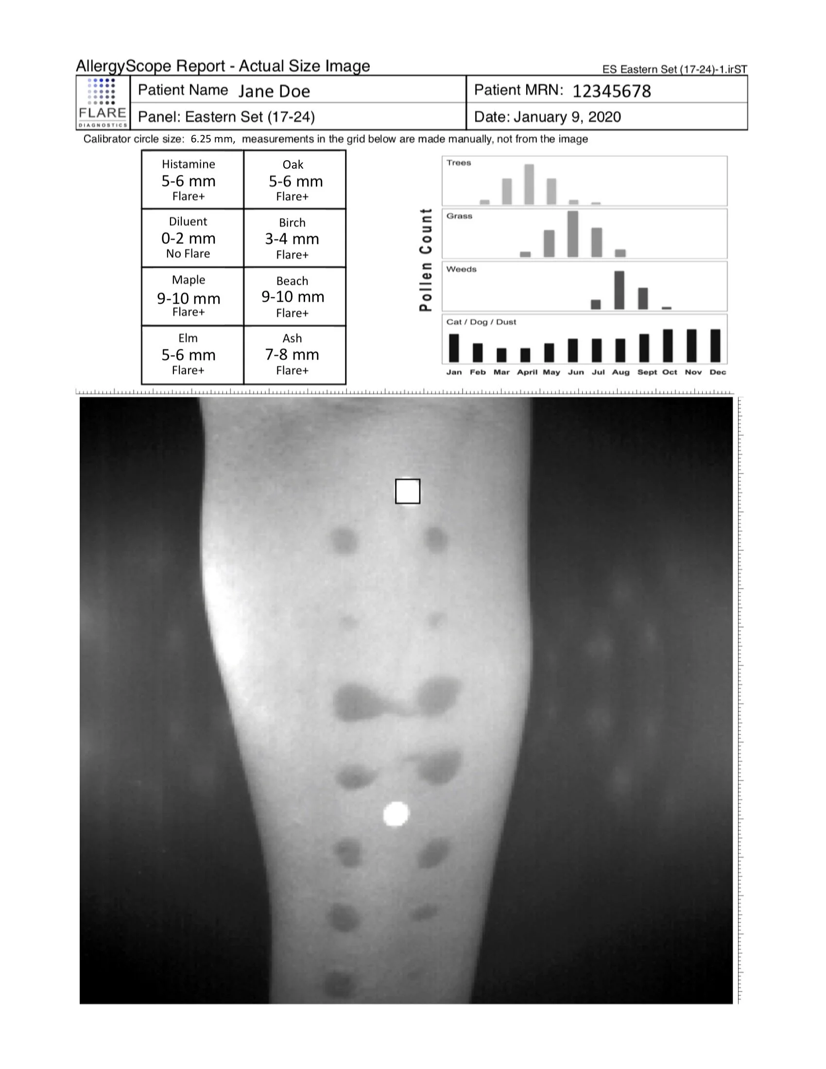 MEDIA — AllergyScope