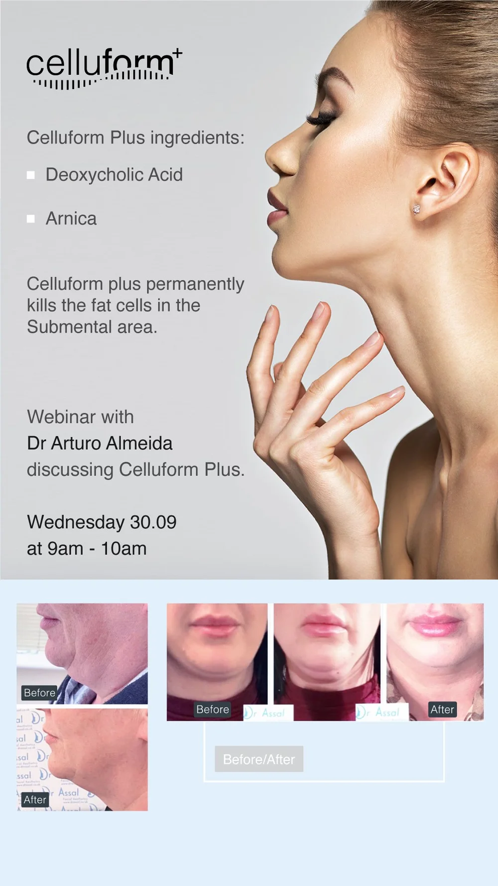 Celluform and Celluform + — Carte Blanche