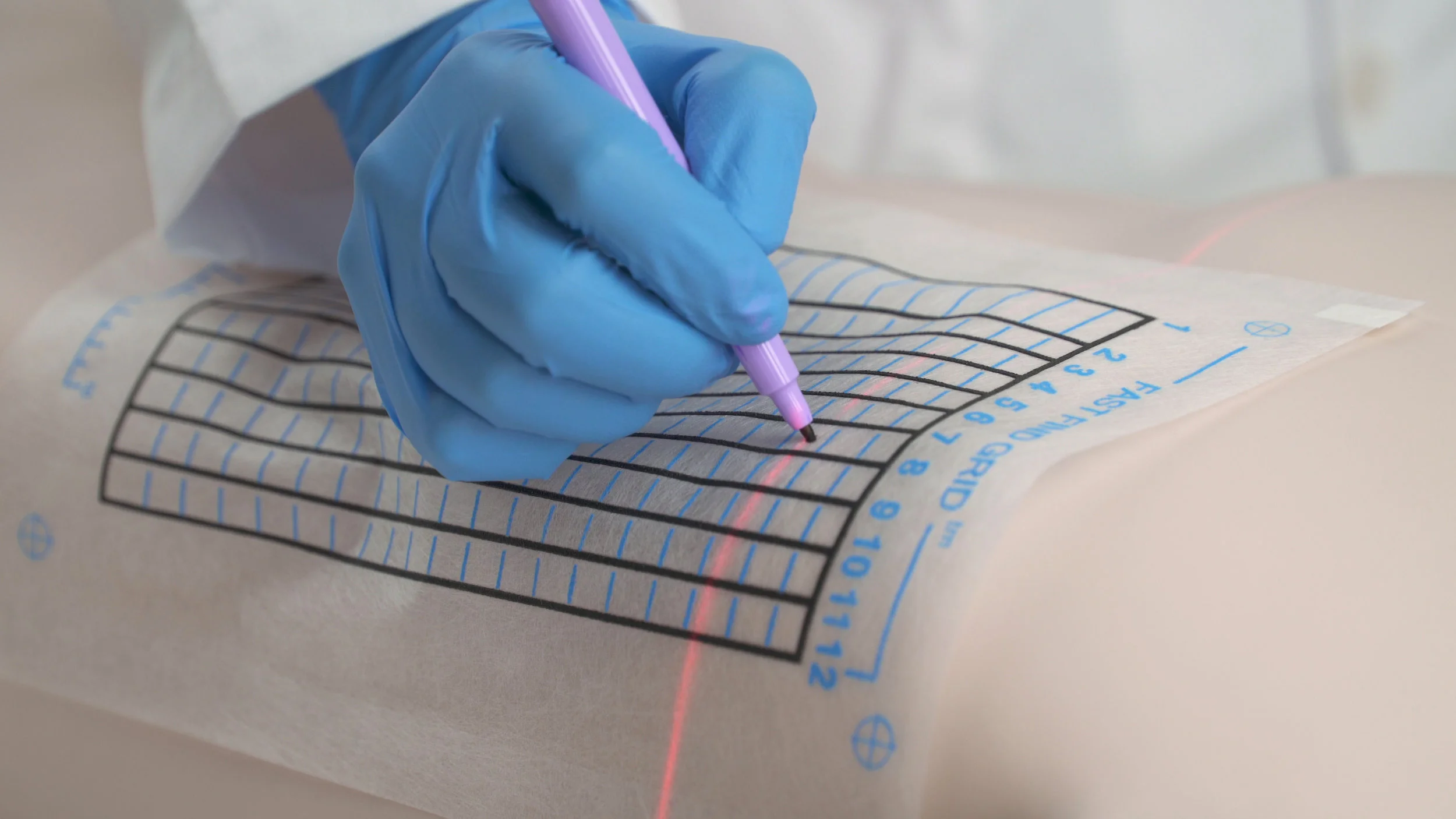 The Fast Find Grid: CT Guided Biopsy Grid — Webb Medical