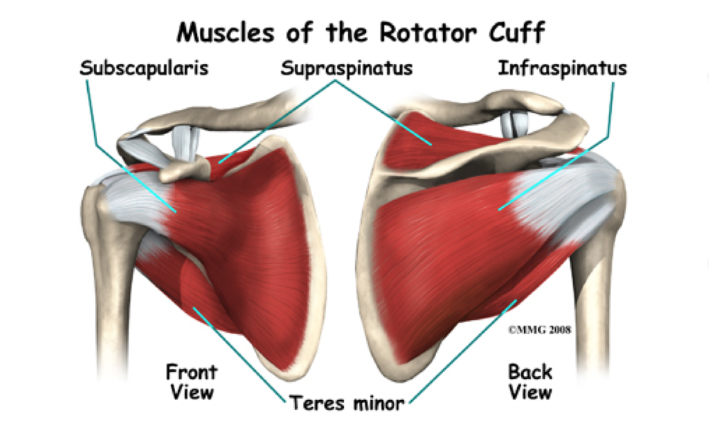 Croydon Physio - Rotator Cuff Tear