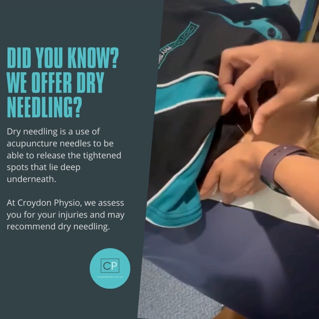 croydonphysio.com.au