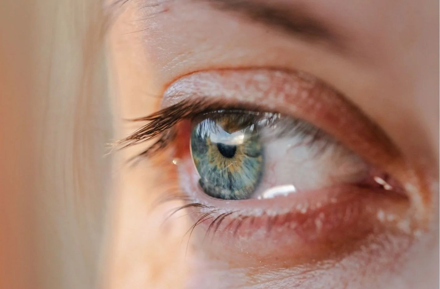 McDonald Adams Optometrists Watery eyes?