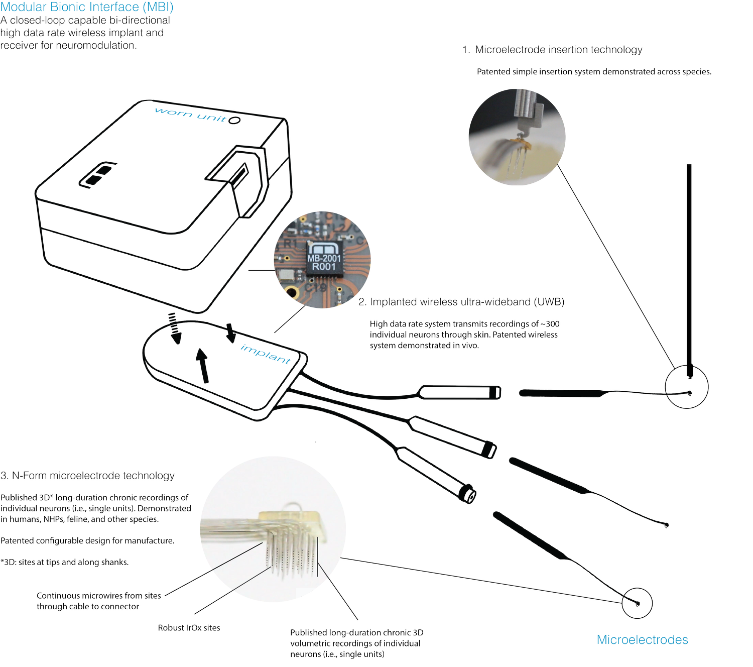 Technology — Modular Bionics