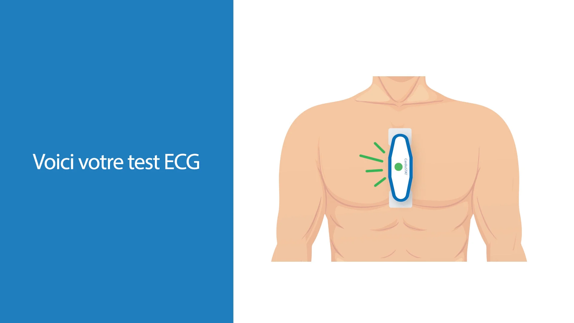 Professionnels- CardioSTAT à domicile | CardioSTAT