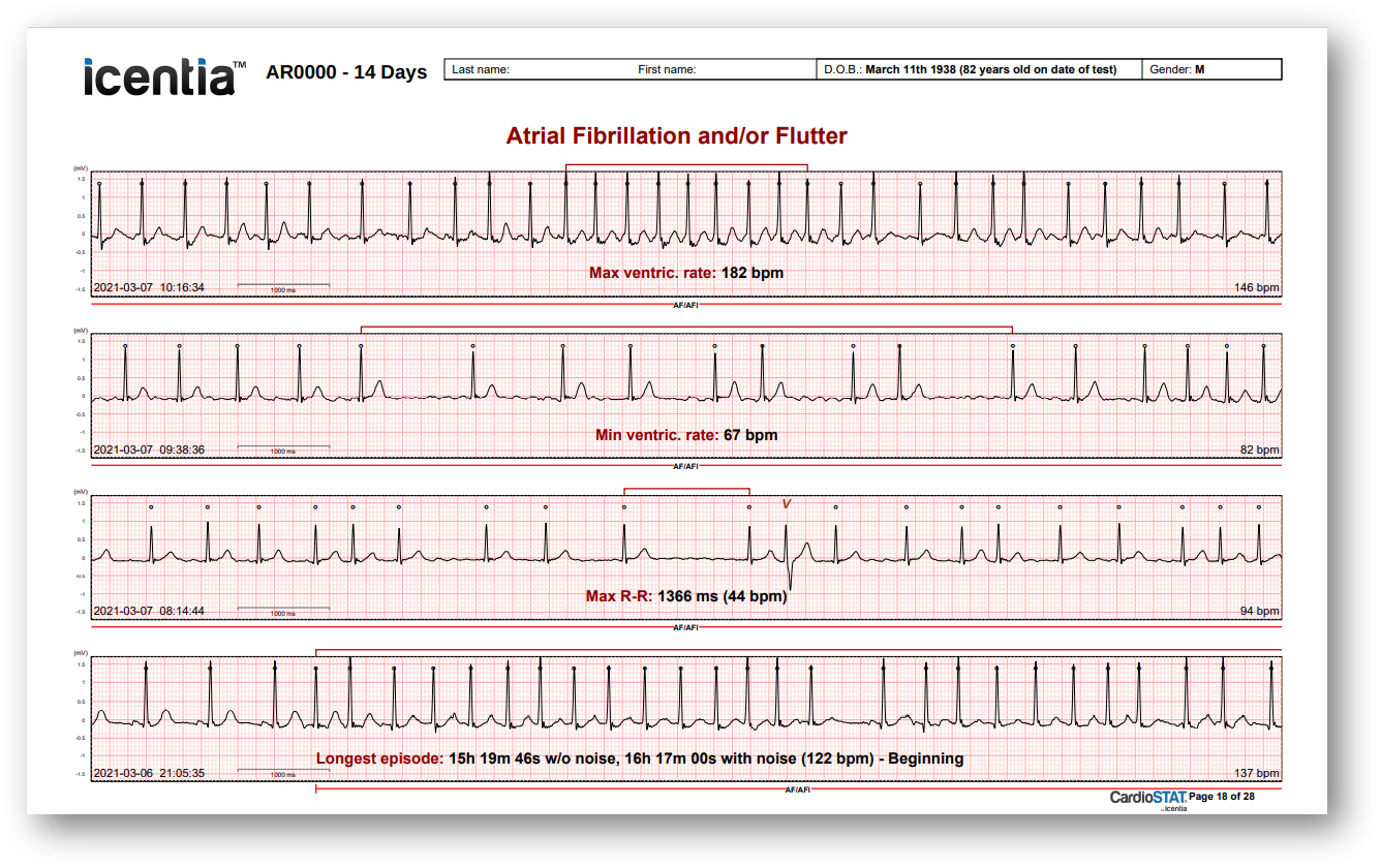 Clear and actionable clinical report | CardioSTAT
