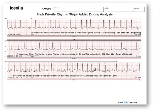 A clear actionable clinical report | CardioSTAT
