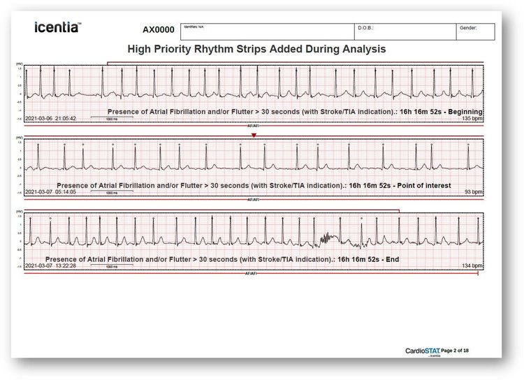 A clear actionable clinical report | CardioSTAT