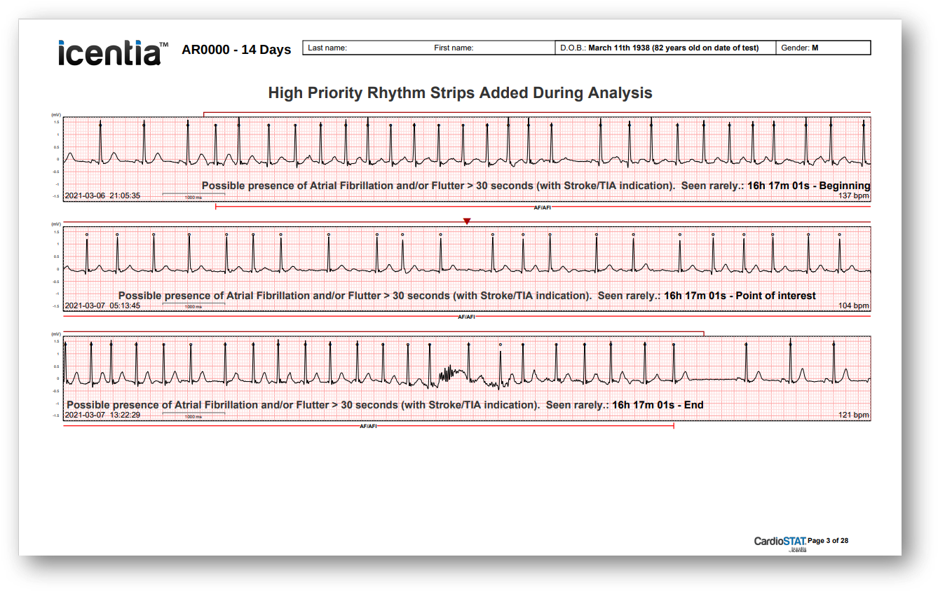 Clear and actionable clinical report | CardioSTAT