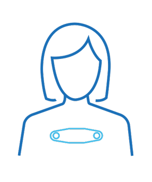 Ambulatory cardiac monitoring simplified | CardioSTAT