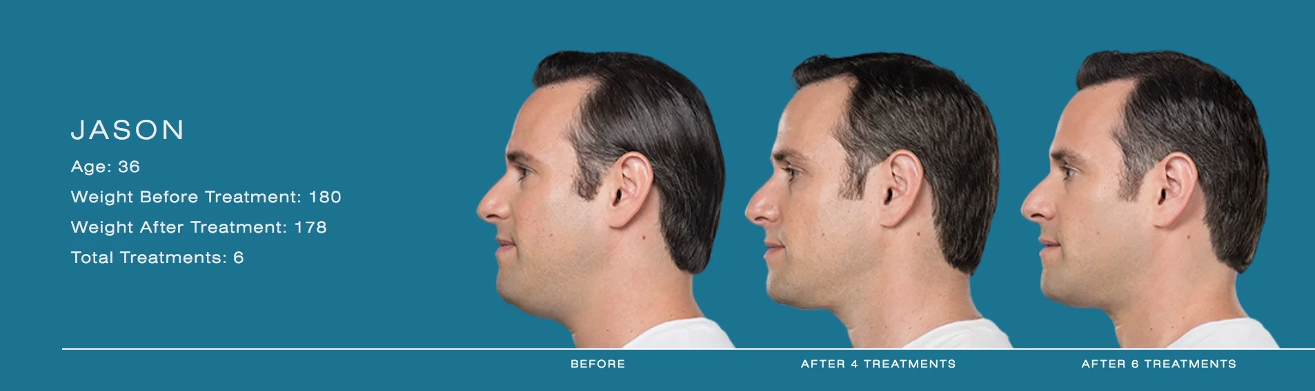 Lakes Dermatology | Serving Burnsville & Minnetonka