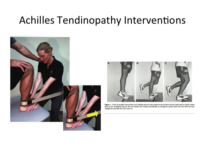 Achilles Tendinopathy and Mend Physical Therapy Solutions — Mend