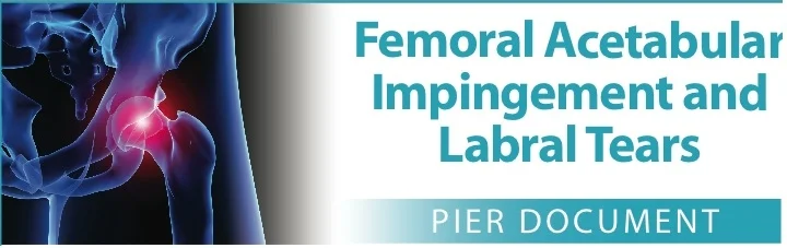 Hip Pain associated with Femoral Acetabular Impingement and Labral ...