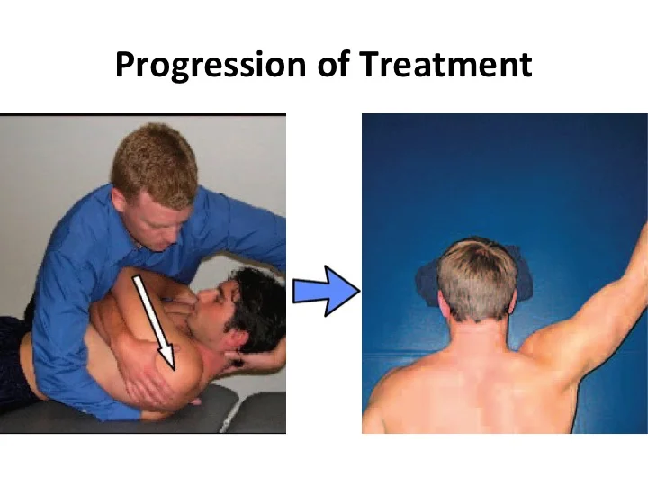 Thoracic Manipulation and Shoulder Pain — Mend