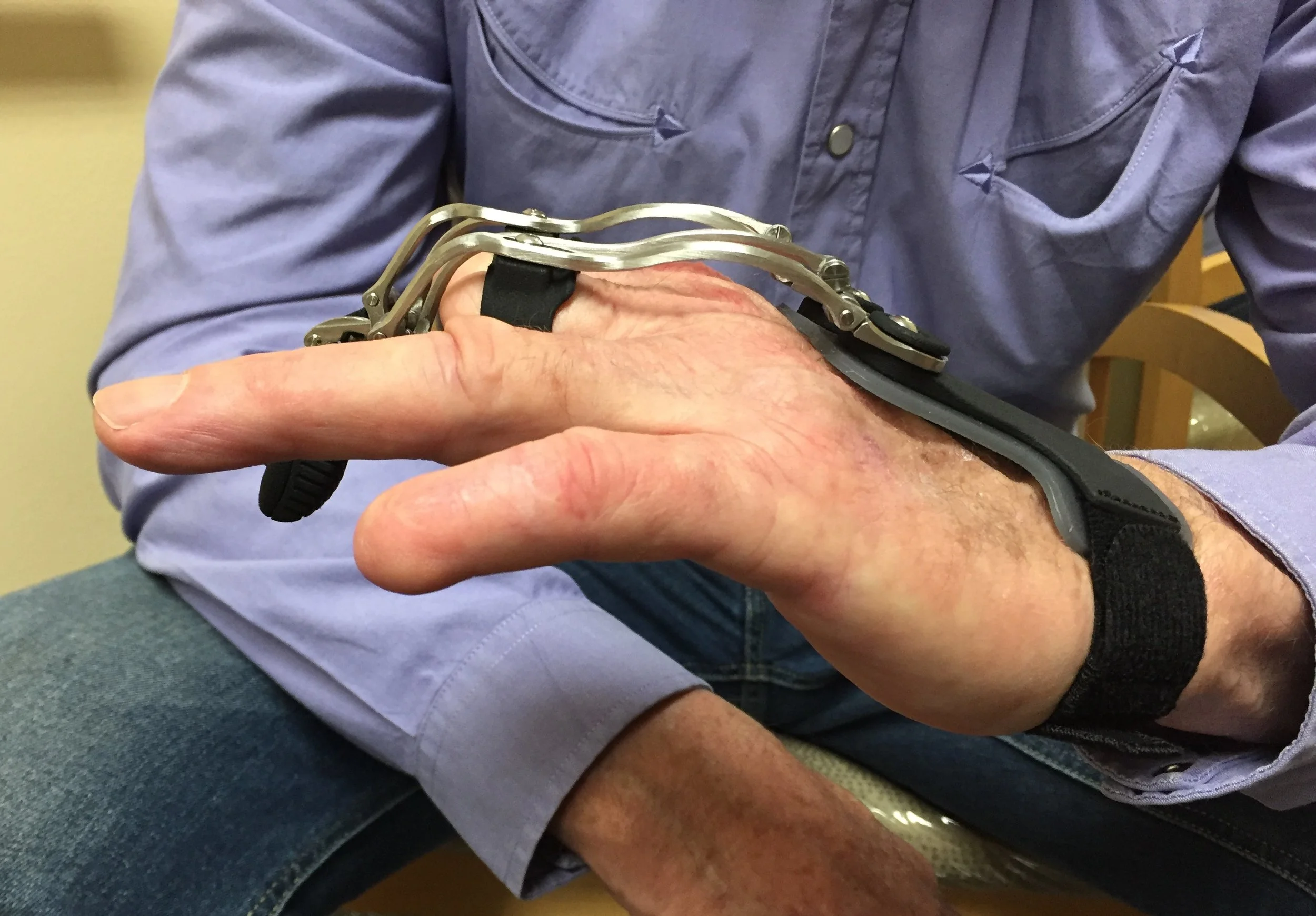 Photos — Anacortes Prosthetics & Orthotics