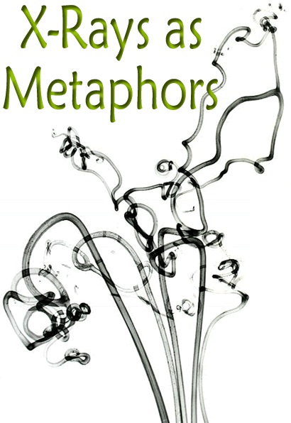 X-Rayography Blog — Beyond Light