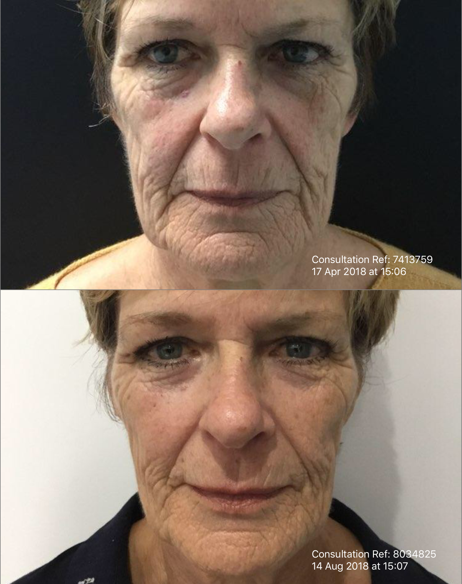 Lumiere MediSpa Cosmetic Skin Clinic Reviews — Lumiere Medispa - Skin ...