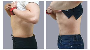 Oxford Weight Loss, Body Contouring, Muscle Growth, Fat Loss, CMSlim ...