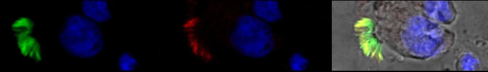 Webinars — BEAT-PCD