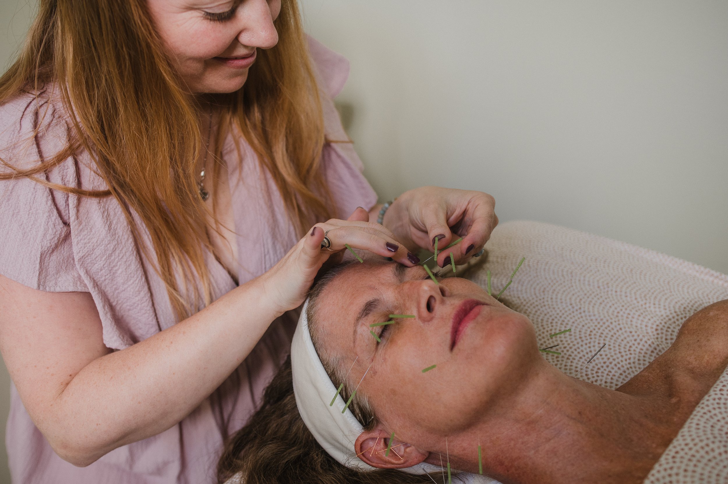 Facial Acupuncture & Microneedling — Dr. Krystal Couture