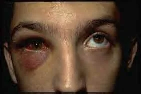 Vital Signs & Sample History-EMT — Hopper Institute®