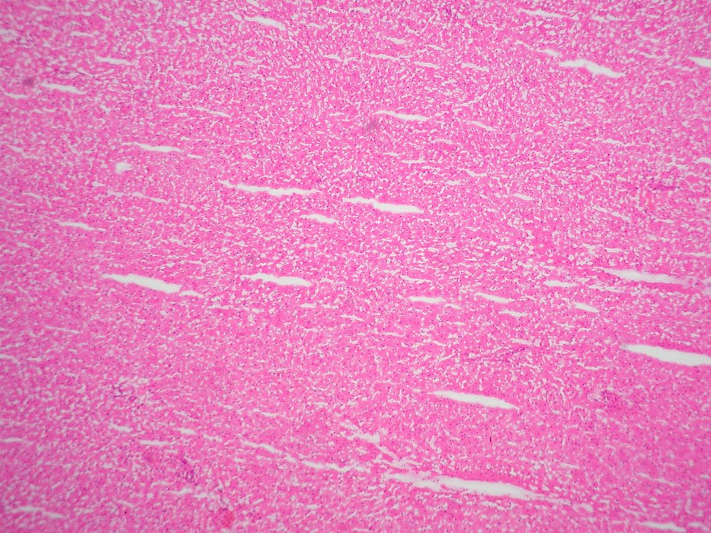 Frozen Section Technique III — Pathology Innovations