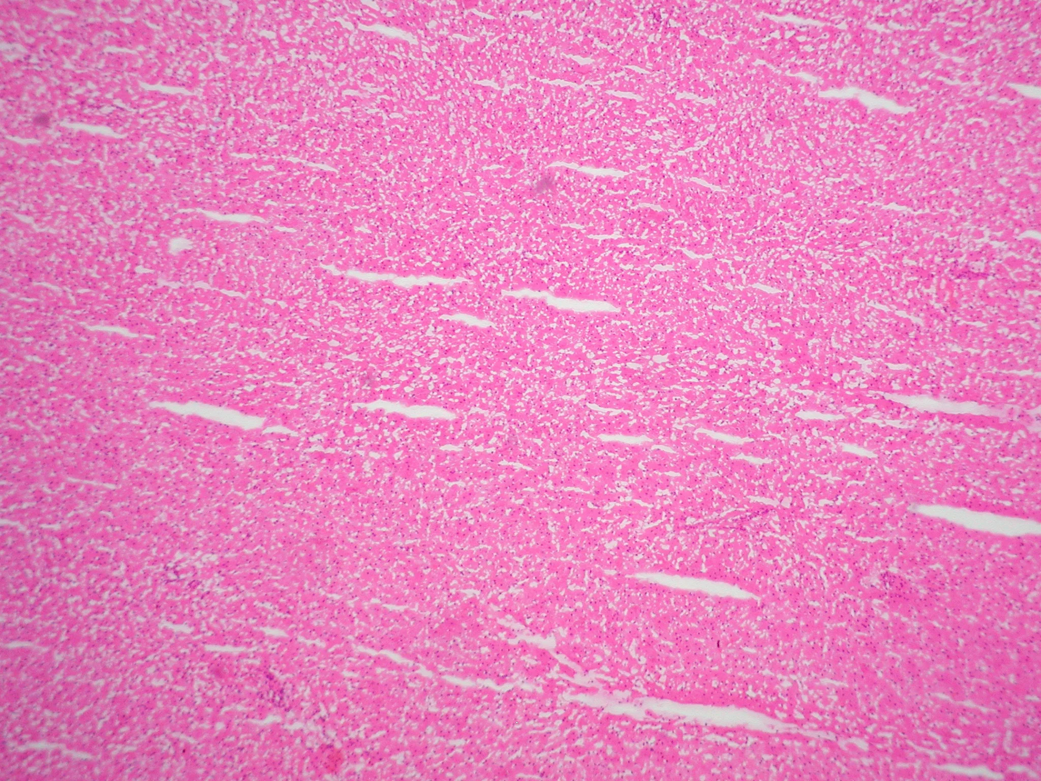 Frozen Section Technique III — Pathology Innovations