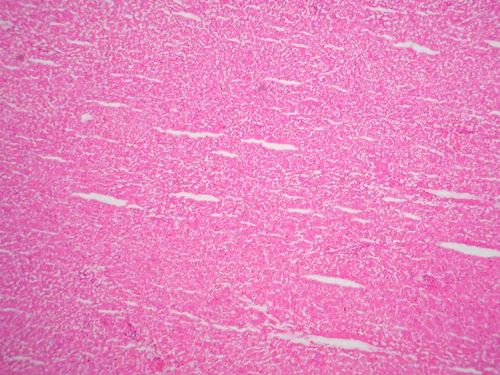 Frozen Section Technique III — Pathology Innovations