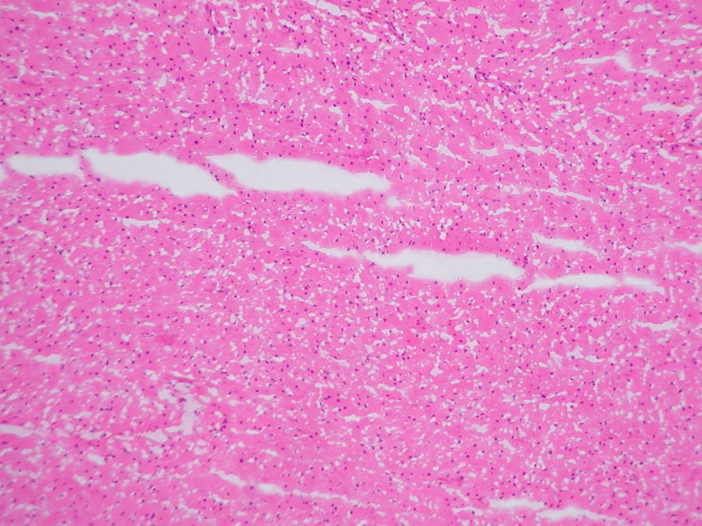 Frozen Section Technique III — Pathology Innovations