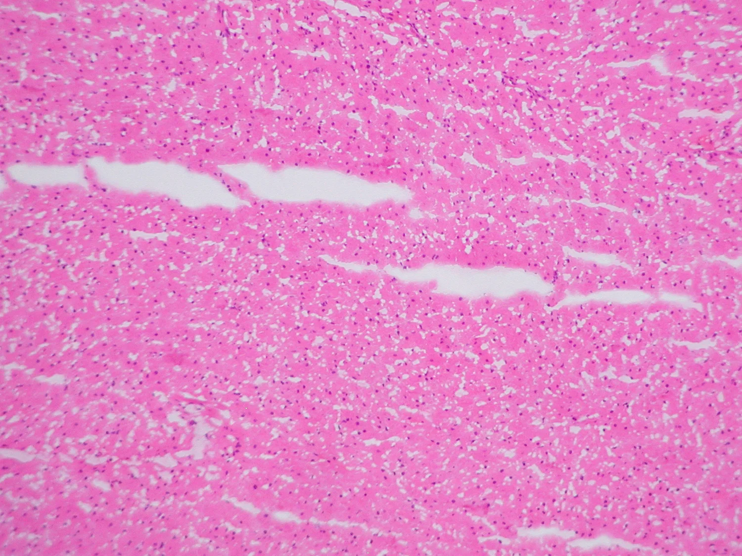 Frozen Section Technique III — Pathology Innovations