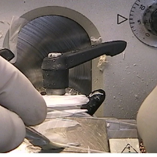 Frozen Section Technique I — Pathology Innovations