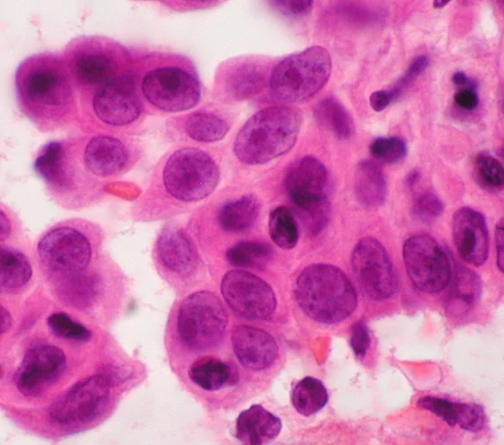Frozen Section Technique I — Pathology Innovations