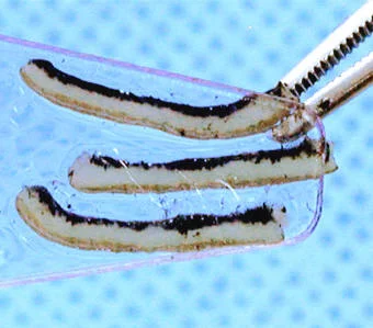 Face Down Cryoembedding — Pathology Innovations
