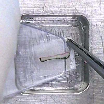 Paper Embedding — Pathology Innovations