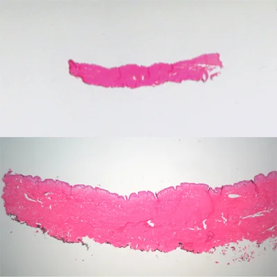 Paper Embedding — Pathology Innovations