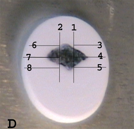 Frozen Block Cryoembedding — Pathology Innovations