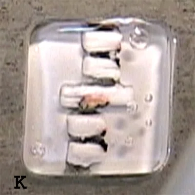 Frozen Block Cryoembedding — Pathology Innovations