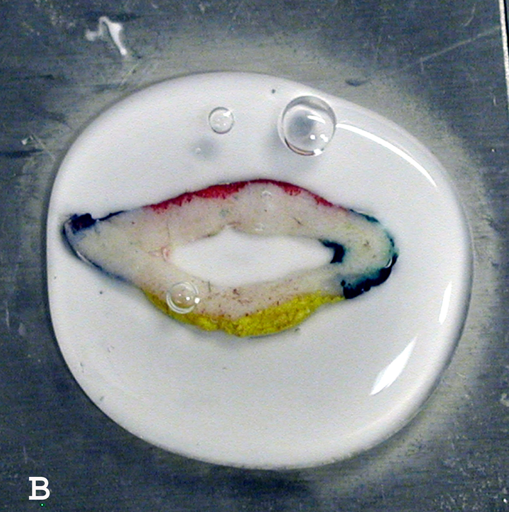 Frozen Block Embedding II — Pathology Innovations