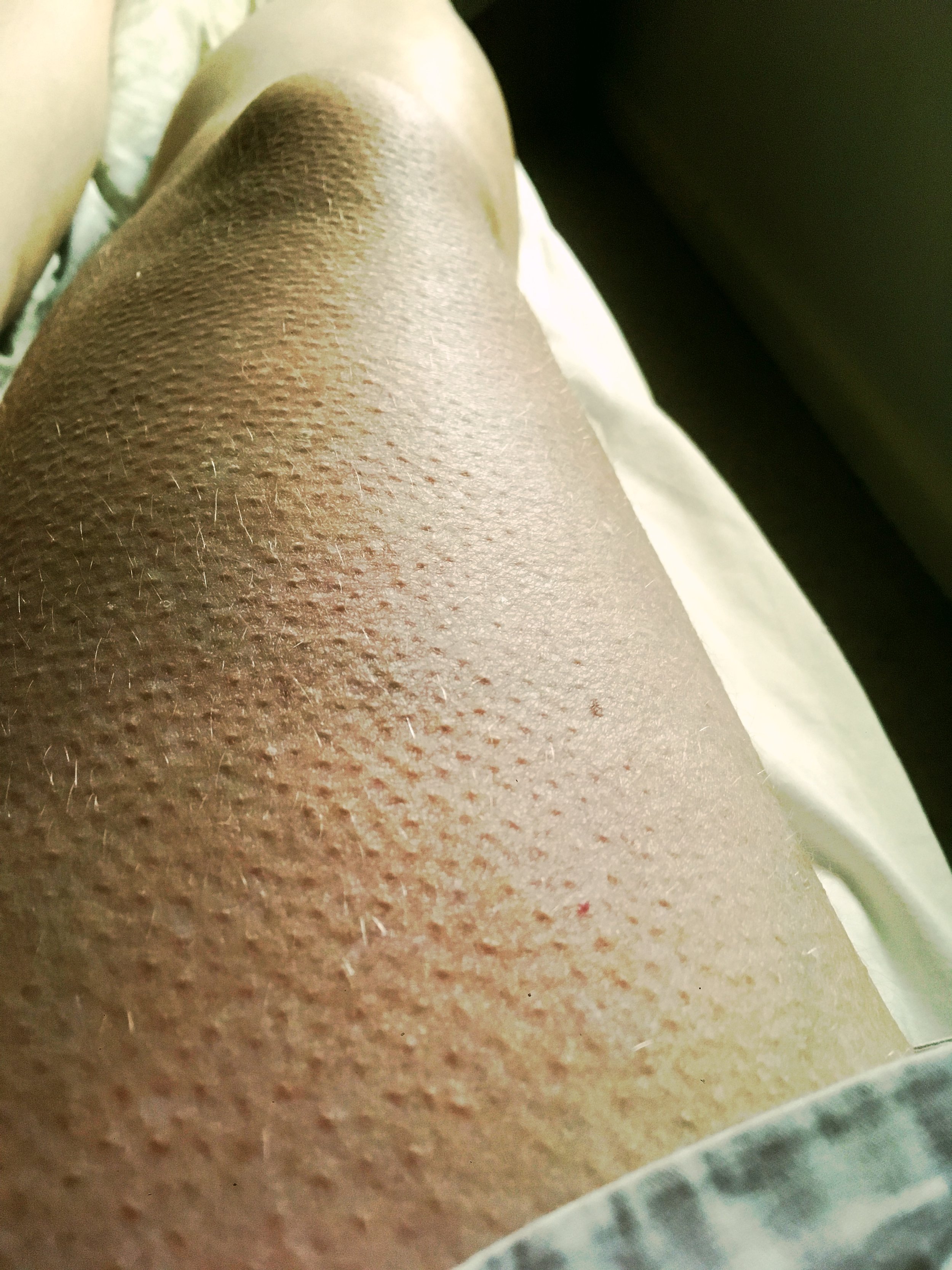 What Do Goosebumps Mean? – Goosebumps: Why they Occur and What they ...