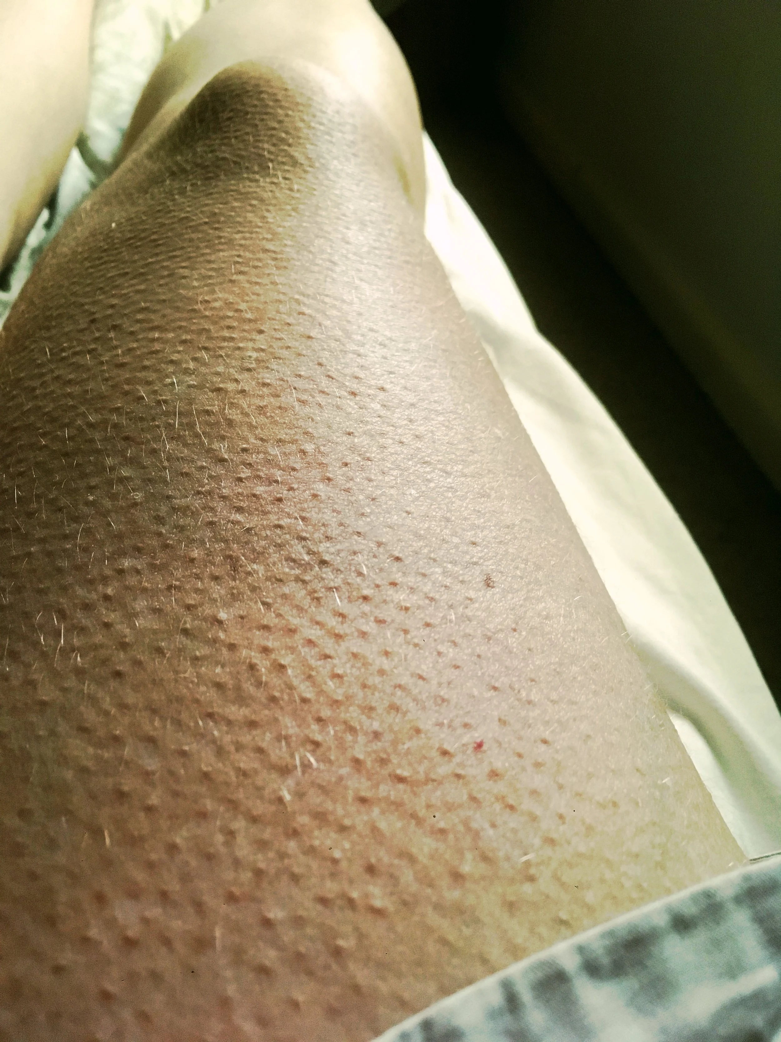 GOOSEBUMPS VERSES TINGLING — Emma-Jane Watson