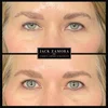 Jack Zamora MD Cosmetic Surgery and Aesthetics - ATTIVA RF
