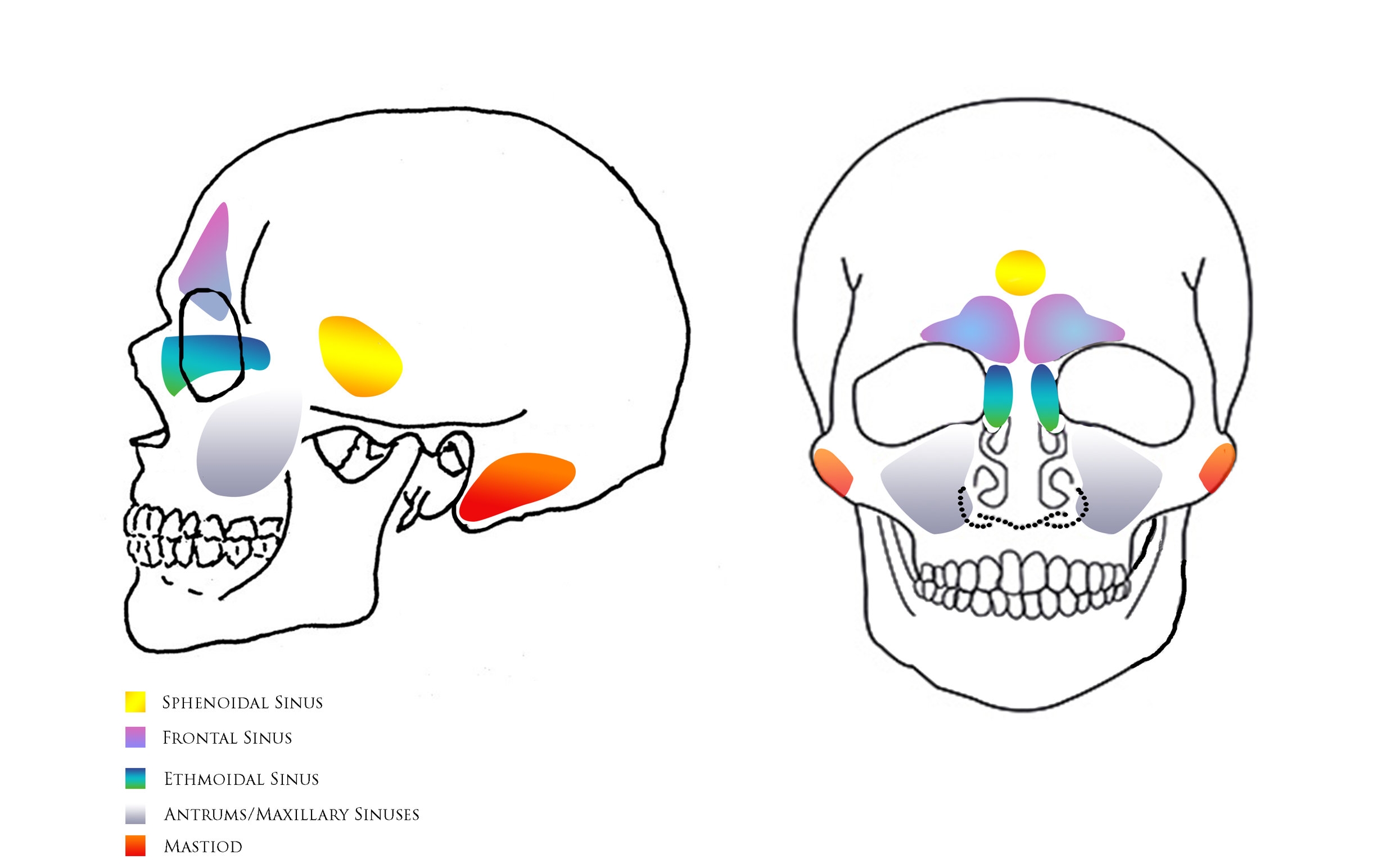 The Sinuses Treatment — Metamorphosis
