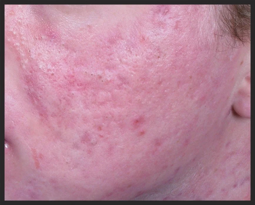 The Dermatology Institute of Victoria | Melbourne Dermatologists— An ...