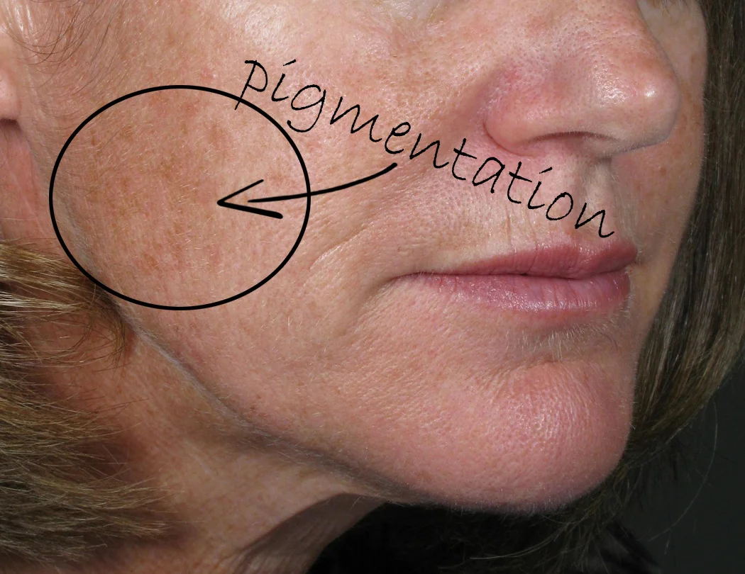 The Dermatology Institute of Victoria | Melbourne Dermatologists— Why ...