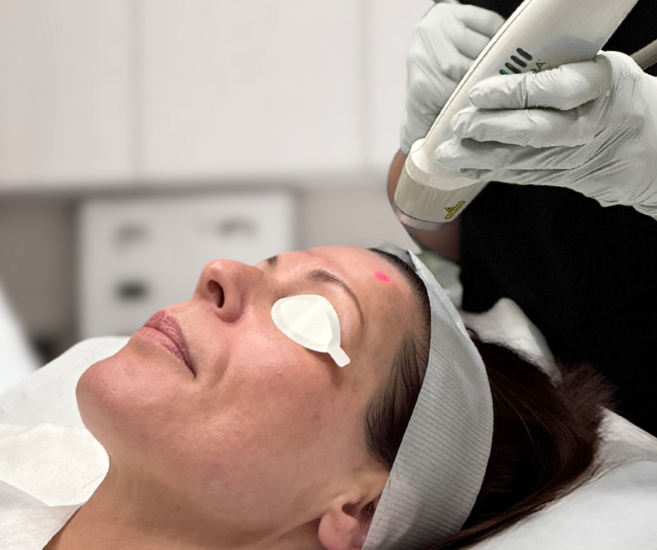 Laser Treatments — The Dermatology Institute of Victoria | Melbourne ...